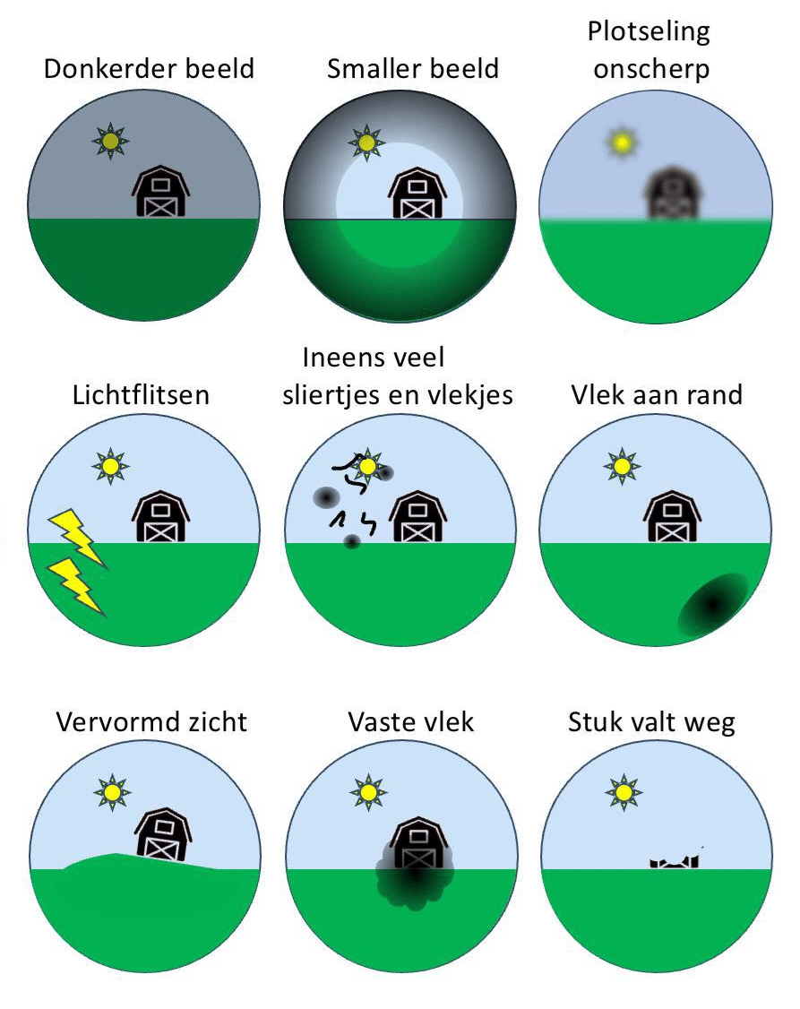 Campagne over risico’s hoge bijziendheid - Oogvereniging